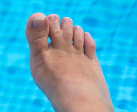 Are Webbed Toes Bad? | FootWebStar