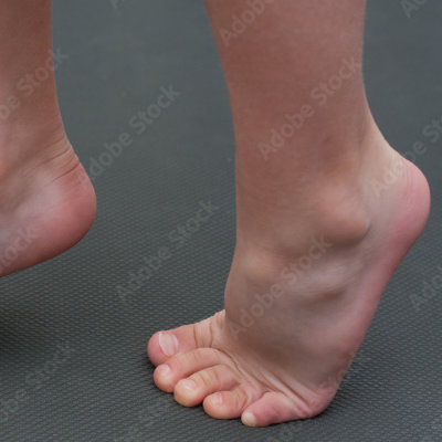 Do stretches help plantar fasciitis pain? | FootWebStar